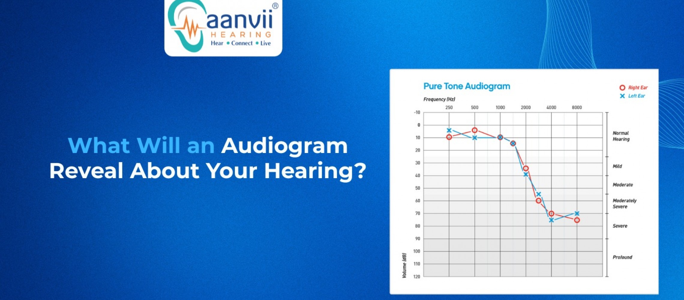 What Will an Audiogram Reveal About Your Hearing? | Aanvii Hearing