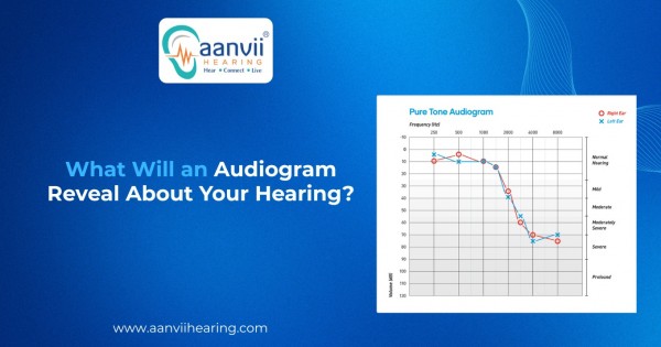 What Will an Audiogram Reveal About Your Hearing? | Aanvii Hearing