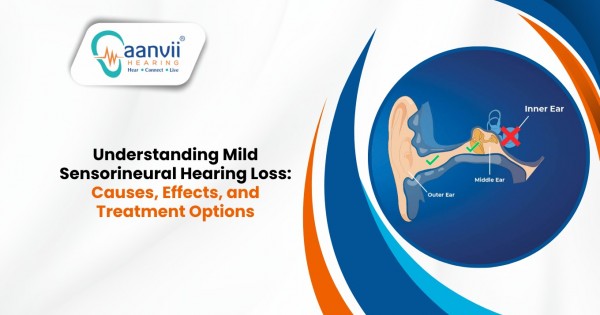 Understanding Mild Sensorineural Hearing Loss: Causes, Effects, and ...
