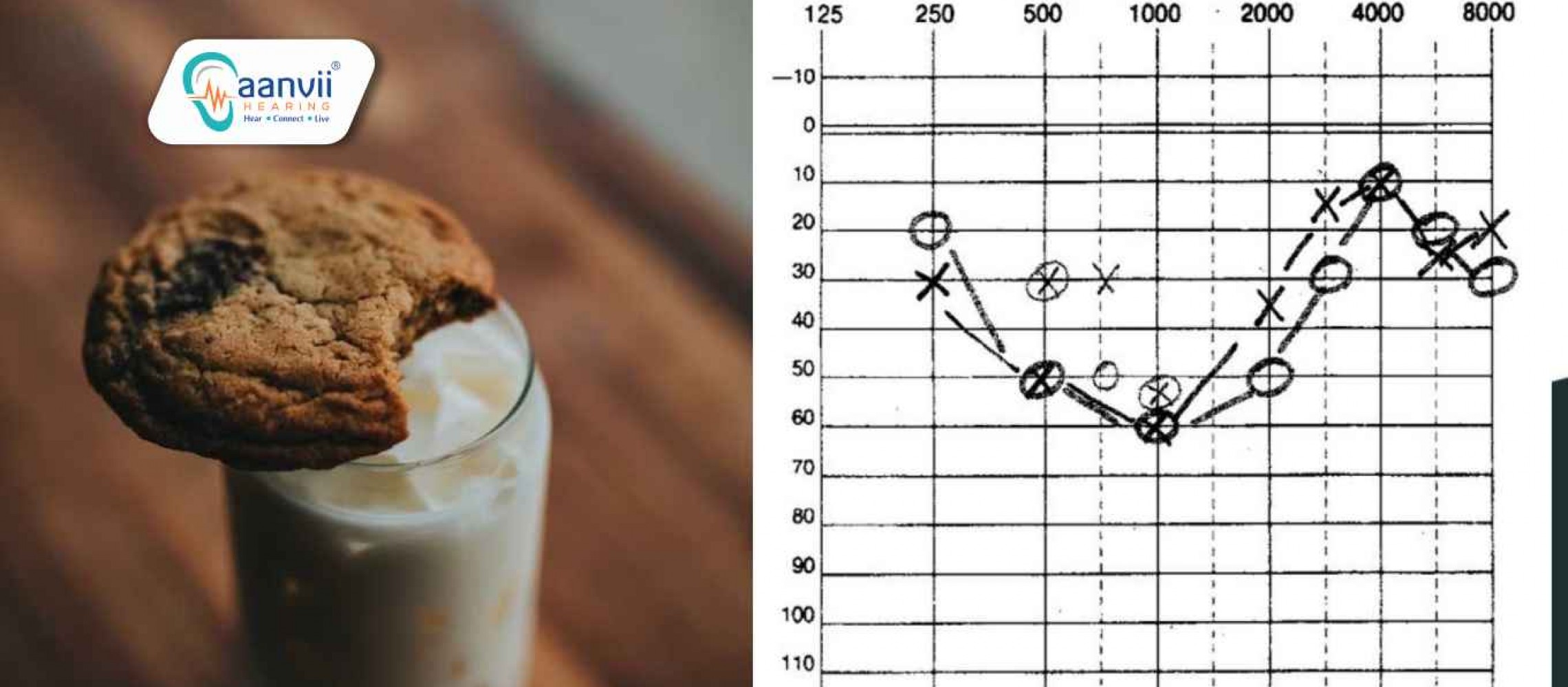 Understanding Cookie Bite Hearing Loss: Causes, Signs, and Treatment ...