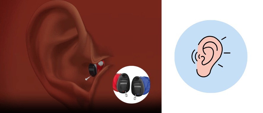 In-The-Ear (ITE) Hearing Aids: Are They Right for You? | Aanvii Hearing