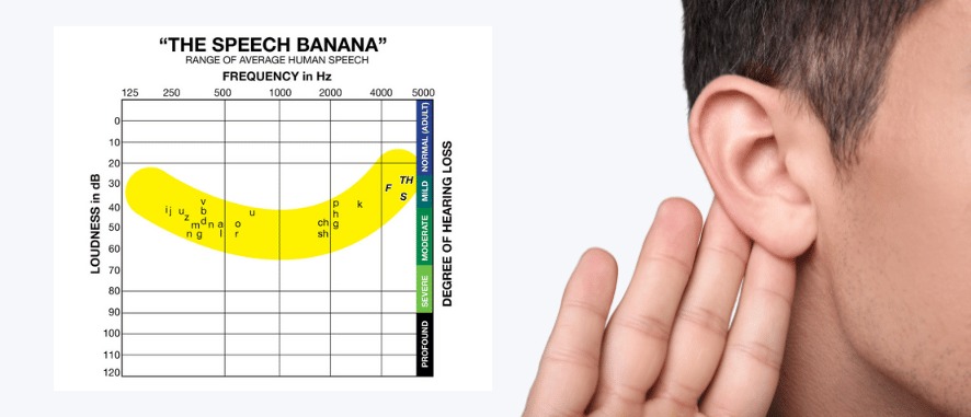 What Do Audiograms and Speech Bananas Have To Do With Your Hearing ...