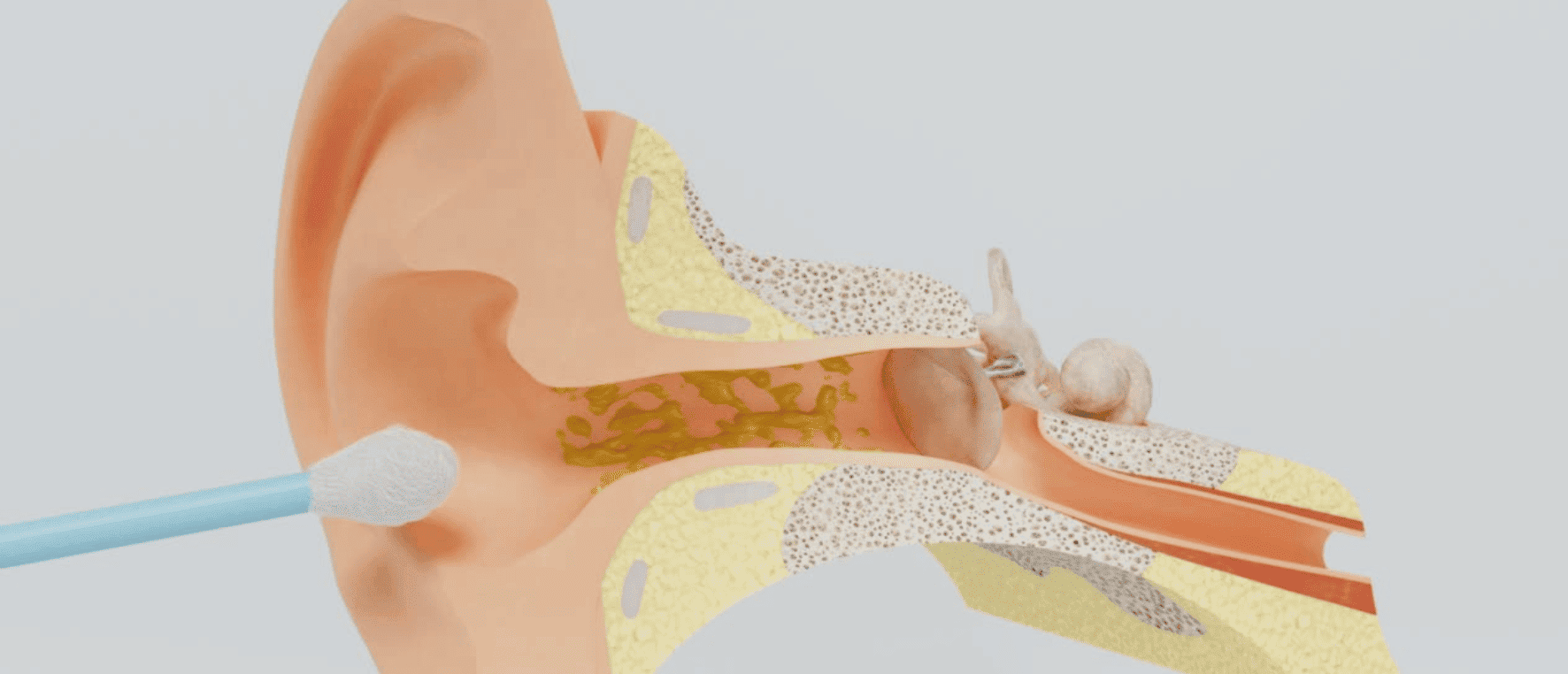 How Does Wax Build-Up Affect Hearing? | Aanvii Hearing
