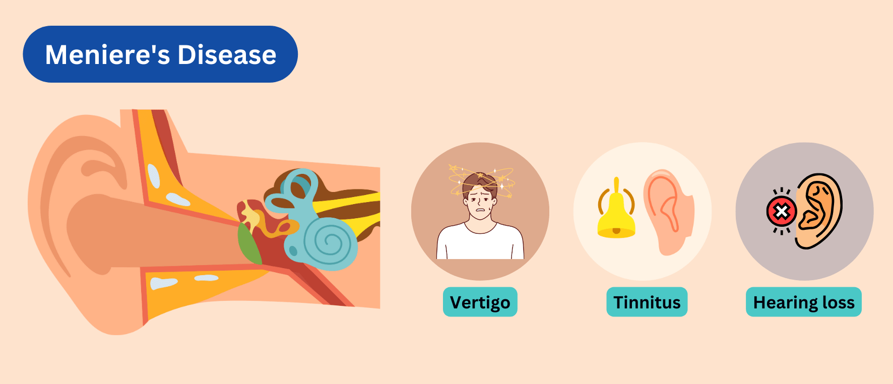 Understanding the Link Between Hearing Loss and Vertigo | Aanvii Hearing